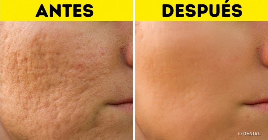 11 Consejos Para Sanar Y Eliminar Cicatrices | Circulo Social